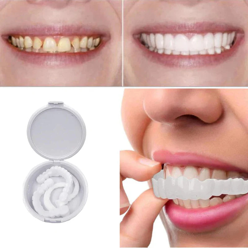 BrightSmile™ Klickbare Zahnveneers | 50% Rabatt – Deloza